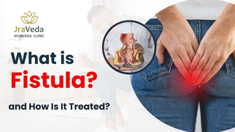 What Is Fistula? Causes, Symptoms & Best Treatment Options in Delhi NCR